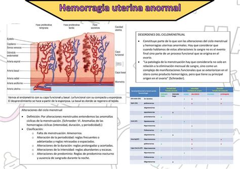Hemorragia Uterina Anormal J Diego P Vásquez uDocz