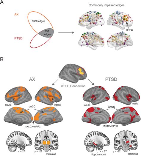 Shared And Distinct Impaired Edges Of The Ax And Ptsd Groups During