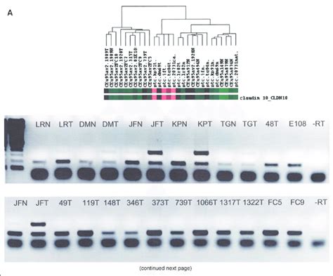 Semiquantitative Reverse Transcriptase Polymerase Chain Reaction Download Scientific Diagram