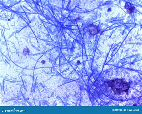 Fungal Hyphae Cells Vector Illustration 130640756