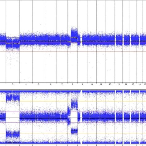SNP Array Results Of A Male Patient With UM Showing Loss Of Chromosome Download Scientific
