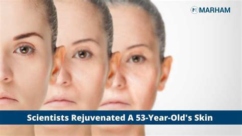 Marham News Scientists Rejuvenated A 53 Year Olds Skin Into A 23 Year