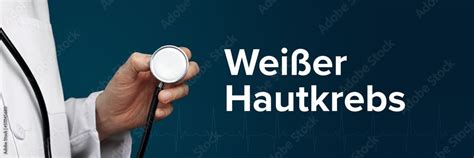 Foto De Weißer Hautkrebs Basaliom Arzt Hält Stethoskop In Hand