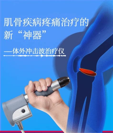 肌骨疾病疼痛治疗的新“神器”——体外冲击波治疗仪澎湃号·湃客澎湃新闻 The Paper