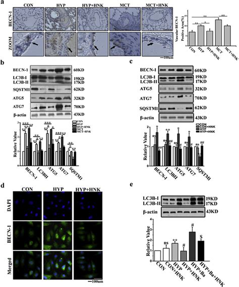 Increased Autophagy In Pulmonary Arterial Hypertension A