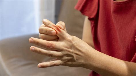 How To Reduce Uric Acid Naturally 5 Tips To Know Healthshots