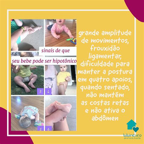 Perguntas E Respostas Sobre Hipotonia