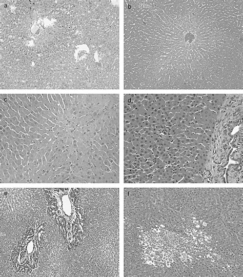 Histopathology A Ischemia Reperfusion Hematoxylin Eosin Section Download Scientific Diagram