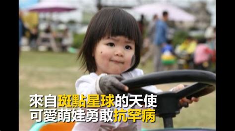 【預告】3歲萌娃勇抗罕病 斑點天使降臨 Youtube