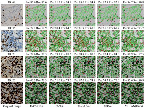 Visualization Of Cell Localization Performance Of Multiple Models On