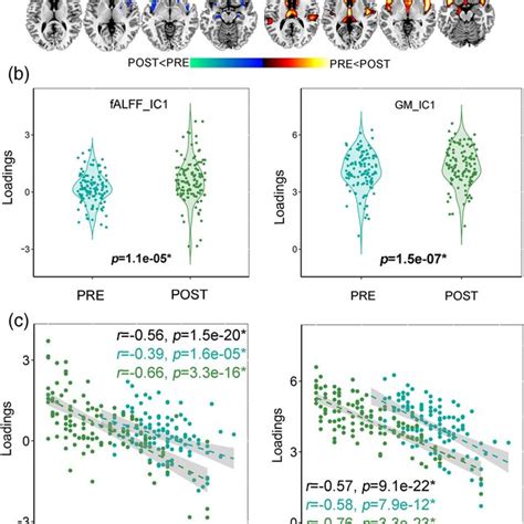 Ect Treatment Responsive Multimodal Brain Networks For A All Dep
