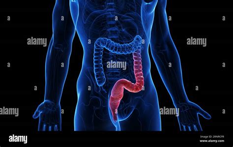 Ulcerative Colitis Illustration Stock Photo Alamy