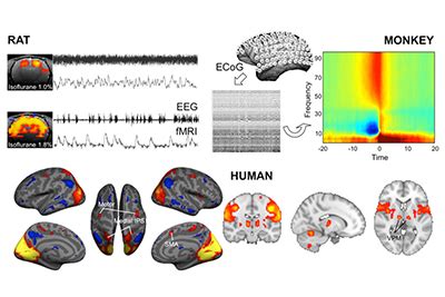 Biomedical Engineering Multimodal And Computational Neuroimaging Laboratory Penn State