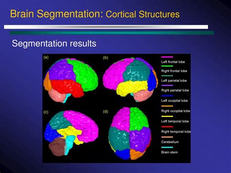 ppt quantitative brain structure analysis on mr images powerpoint presentation id 4525725