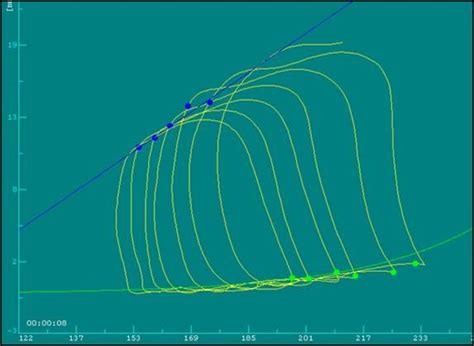 Figure Regression Of PV Loops During Occlusion Of Inferior Vena Cava