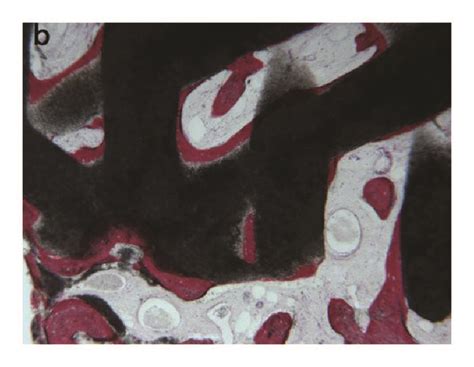 Synthetic Micro Macroporous Biphasic Calcium Phosphate Ha β Tcp 3070 Download Scientific