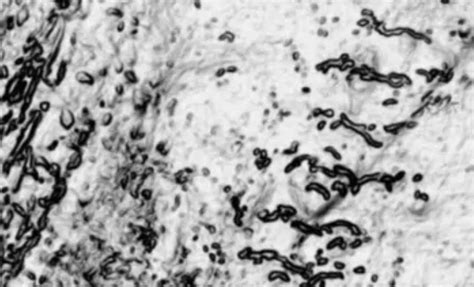 Giant Glacial Features Under The North Sea Rewrite Ice Age History Archynewsy