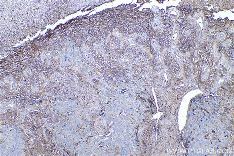 Ihceasy Tgfbi Ready To Use Ihc Kit Khc0729 Proteintech 武汉三鹰生物技术有限公司