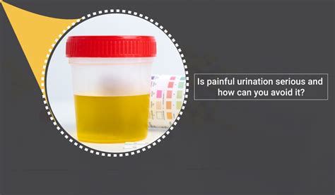 Painful Urination Causes Symptoms And Treatment