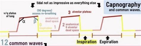 Capnography Waveforms Flashcards Quizlet