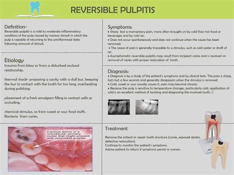 Reversible Pulpitis Treatment Outcomes Of Pulpotomy In Primary Teeth