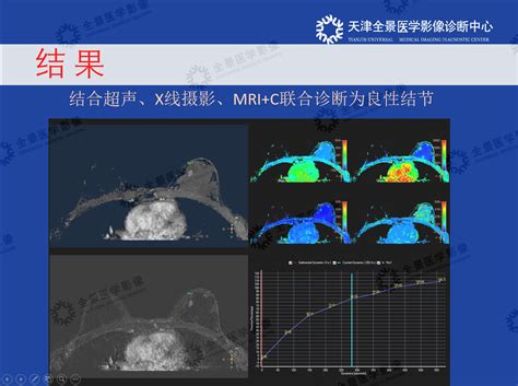 第三十七期天津中心乳腺专场 影像技术评审会 全景医学影像