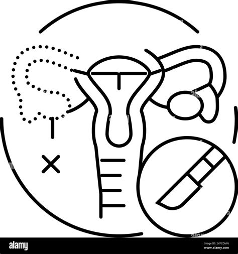 Oophorectomy Surgery Hospital Line Icon Vector Illustration Stock