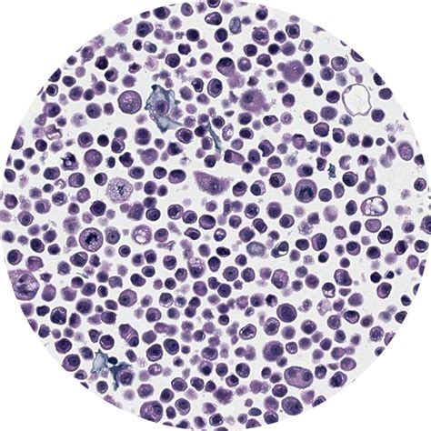 Cell Culture Microarrays Cancer Controls