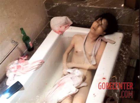 【閲覧注意】バリ島で襲われた美少女・観光客の全裸ビフォーアフター、ヤバすぎる（画像あり） ポッカキットポッカキット