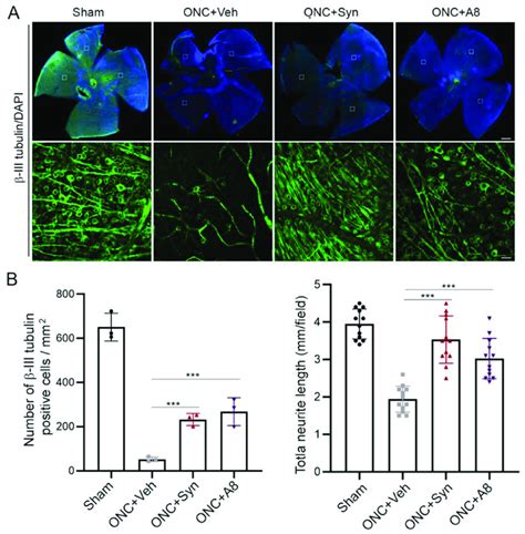 Onc Induced Rgc Loss Was Alleviated By Synaptamide Or A8 Treatment