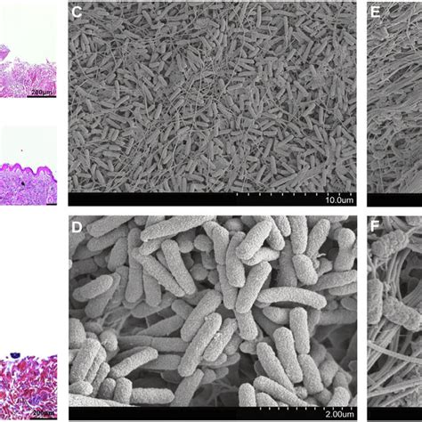 Antibiofilm Activity Of Bio Kþ Illustrated With Sem On Ex Vivo Human