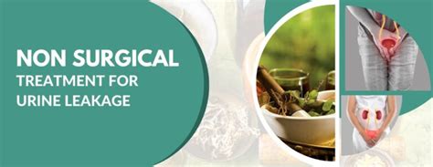 Non Surgical Treatment For Urine Leakage Urinary Leakage Without Surgery