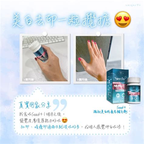 Uniqueus 【🙋🏻‍♀️真實用家分享💯】 大個咗之後就發覺新陳代謝真係慢咗好多~