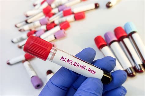 High Transaminases Causes Symptoms And How To Act