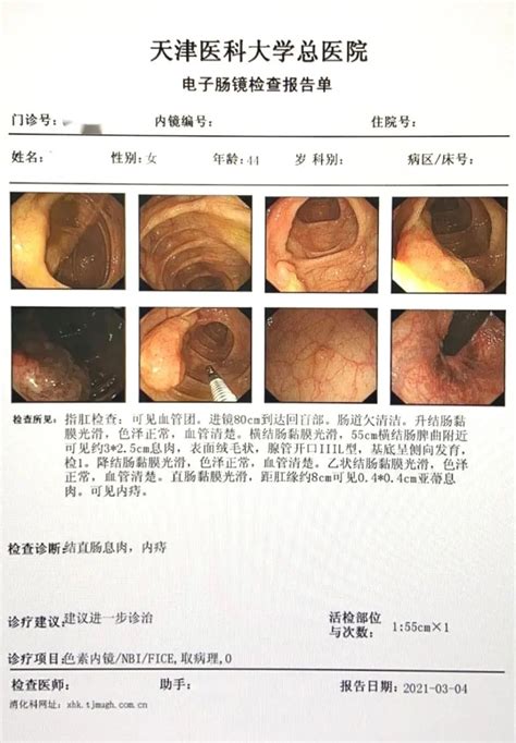 病例故事：一直以为患痔疮，不料被诊断为早期肠癌 早筛网