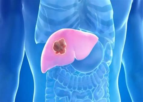 Diseases রোগ Dm3s