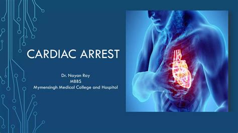 Cardiac Arrest Updated Pdf First Aid Injuries