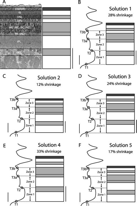 Schematic Diagrams Of The Relationship Between A Representative LRP And Download Scientific