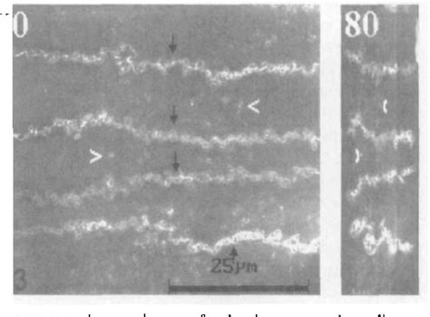 Figure 3 From Confocal Microscopy Of Human Lens Membranes In Aged