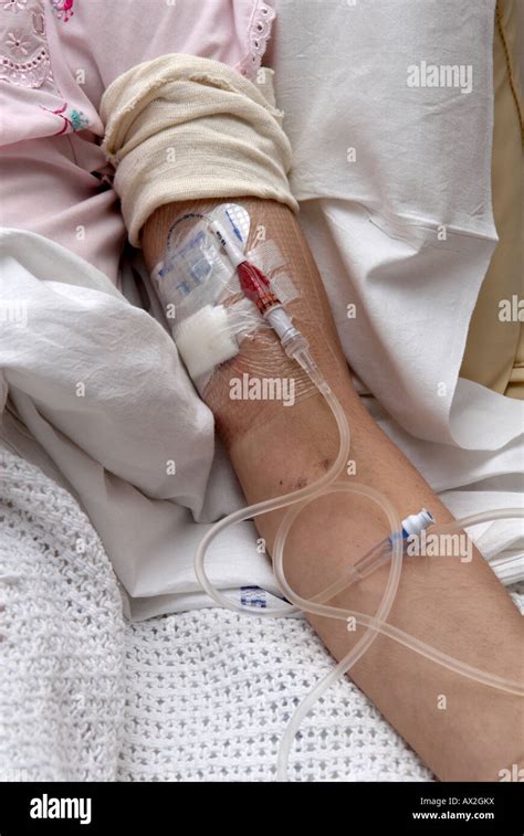 Picc Line Hi Res Stock Photography And Images Alamy