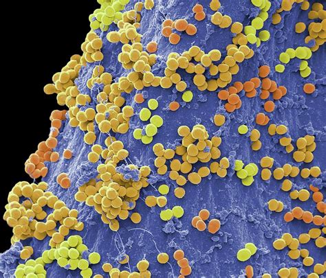 Staphylococcus Bacteria Photograph By Steve Gschmeissnerscience Photo