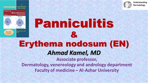 Panniculitis And Erythema Nodosum En Youtube