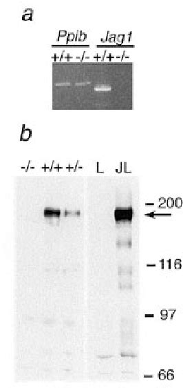 Congenital Ocular Coloboma Disorder Semantic Scholar
