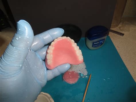 Homemade Denture Kits At Kenneth Keene Blog