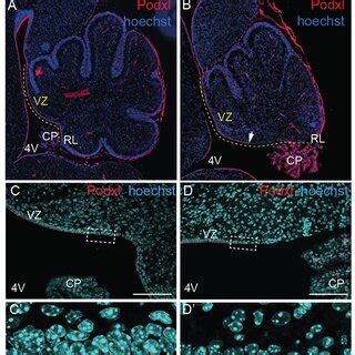 Irregular Pattern Of Purkinje Cells And Bergman Glia Immunofluorescent