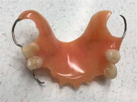 Partial Cast Acrylic Dentures Flippers And Custom Options Grantham Denture Clinic