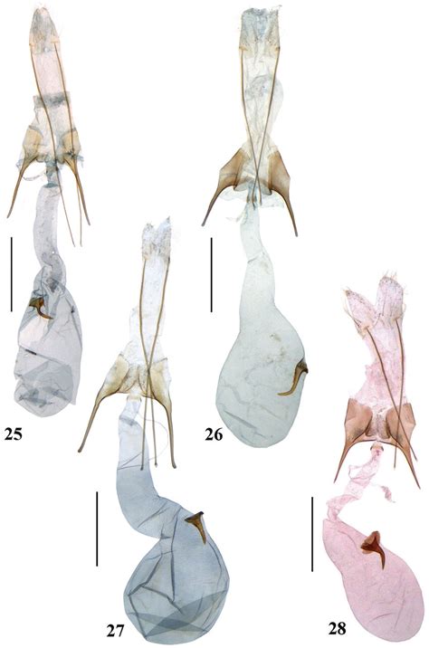 Female Genitalia Of Scrobipalpa Species 25S Triangulella Sp N HT Download Scientific