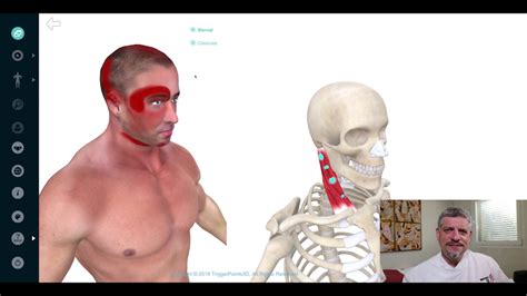 Sternocleidomastoid Trigger Points
