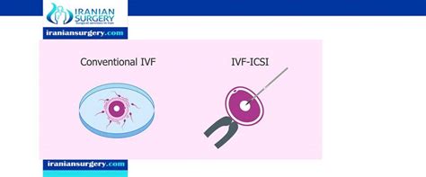 What Is The Difference Between ICSI And IVF Iranian Surgery