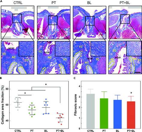 Collagen Deposition In Fenestrated Trachea After Pt And Bl Treatments